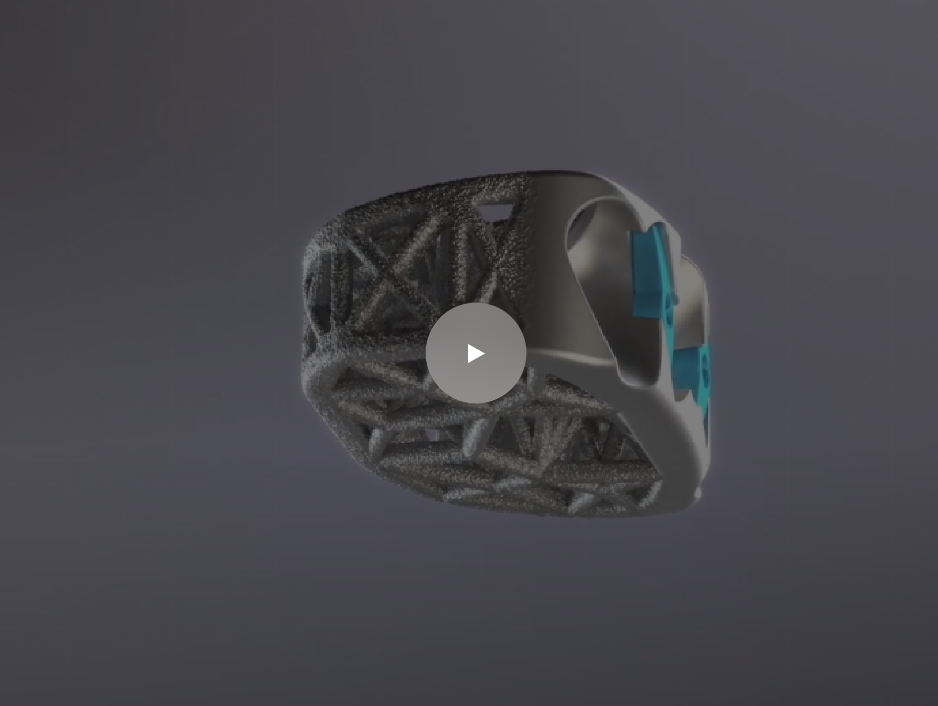 Anterior Spine Truss System™ - Stand Alone - 4WEB