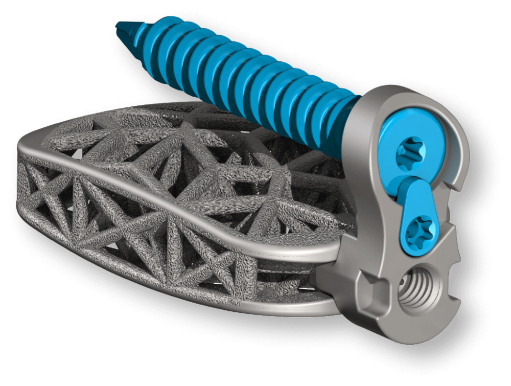 Lumbar Spine Truss System Plating Solution™ - 4WEB