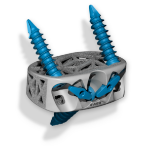4WEB - Proprietary Truss Implant Technology