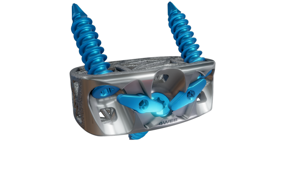 4WEB - Proprietary Truss Implant Technology
