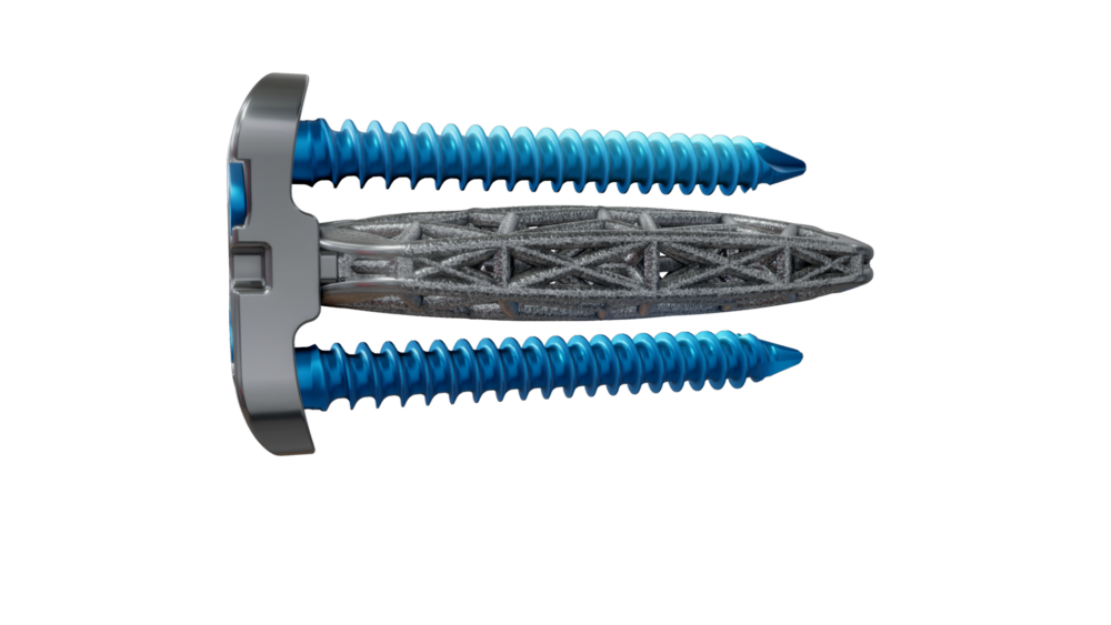 4WEB - Proprietary Truss Implant Technology