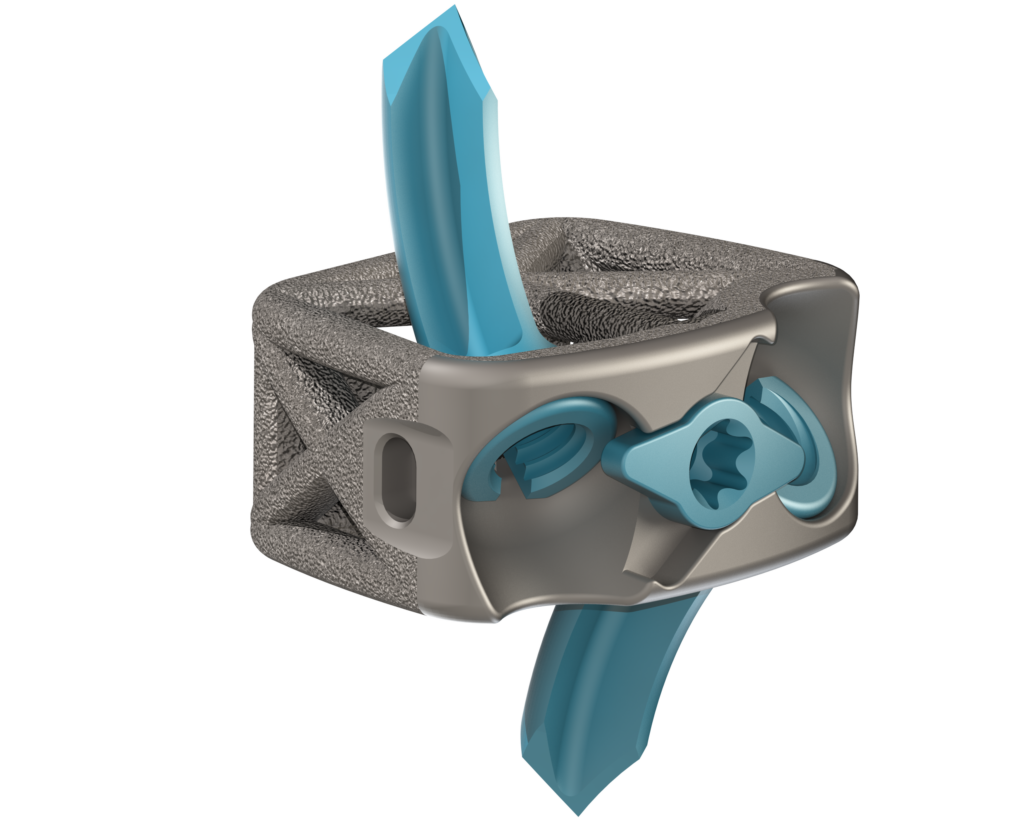 Cervical Spine Truss System™ - Anchor Fixation - 4WEB