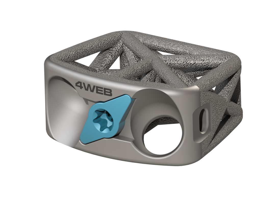 Cervical Spine Truss System™ - Anchor Fixation - 4WEB